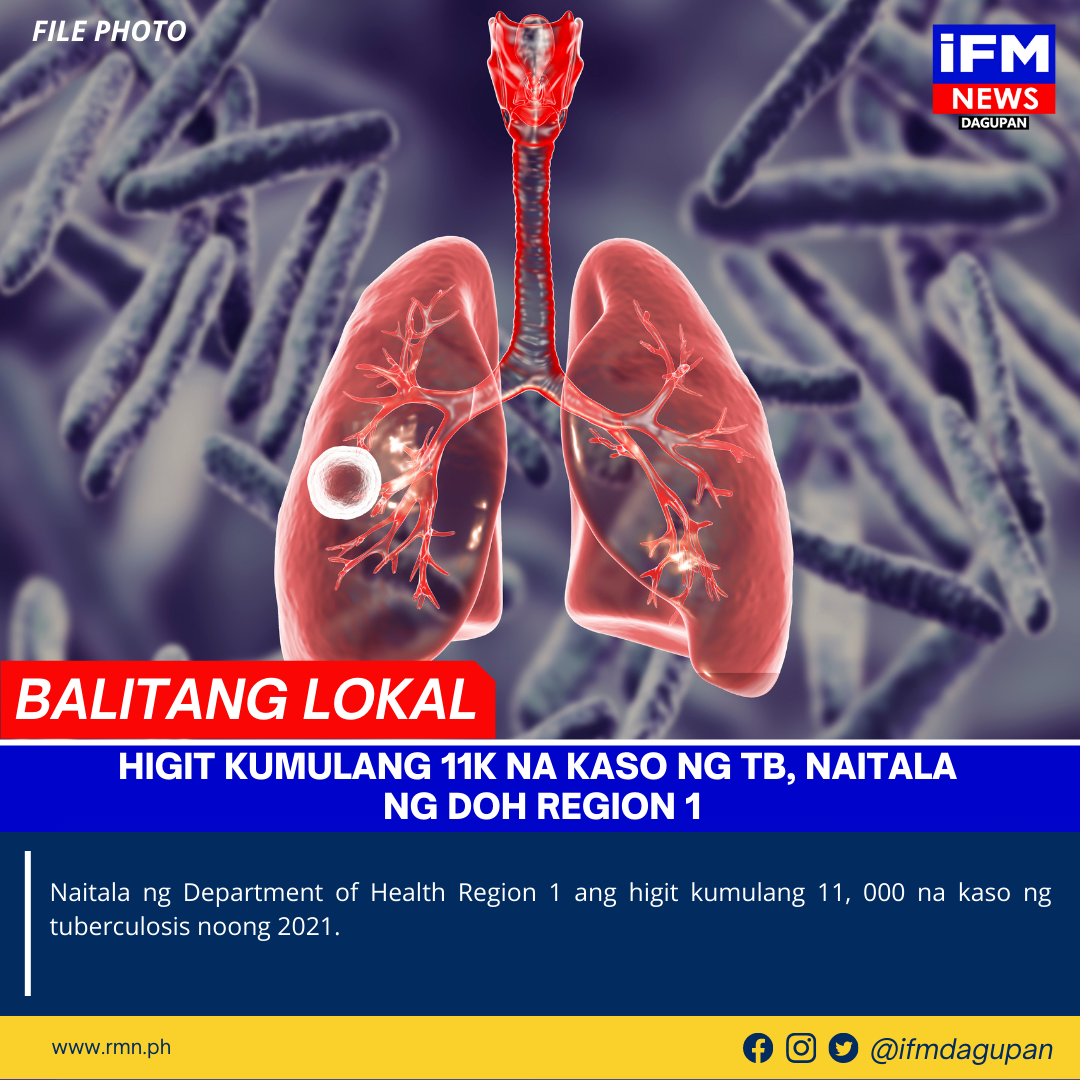 HIGIT KUMULANG 11K NA KASO NG TB, NAITALA NG DOH REGION 1 - RMN Networks