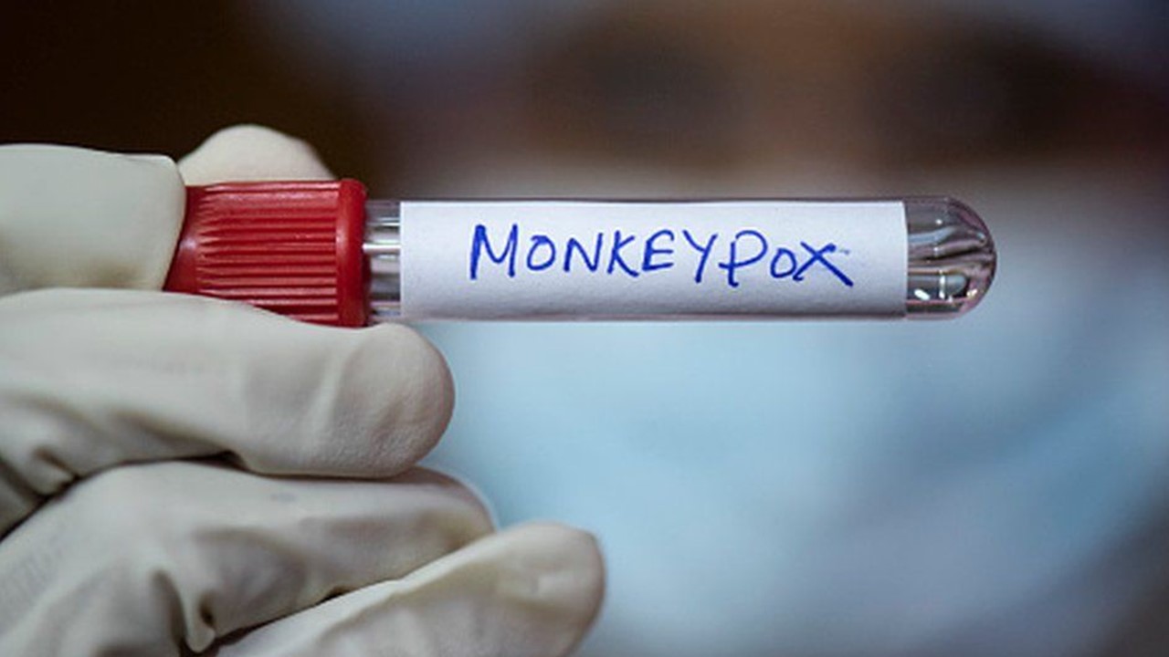 Sampung close contacts ng unang kaso ng monkeypox virus sa bansa ...