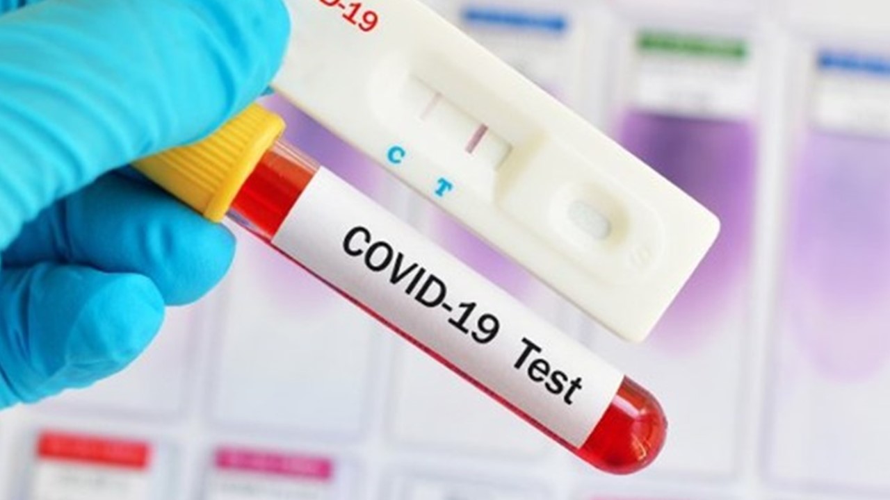 RT-PCR test result, hindi na obligado sa mga biyahero at turistang ...