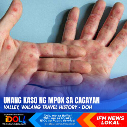 UNANG KASO NG MPOX SA CAGAYAN VALLEY, WALANG TRAVEL HISTORY - DOH - RMN Networks