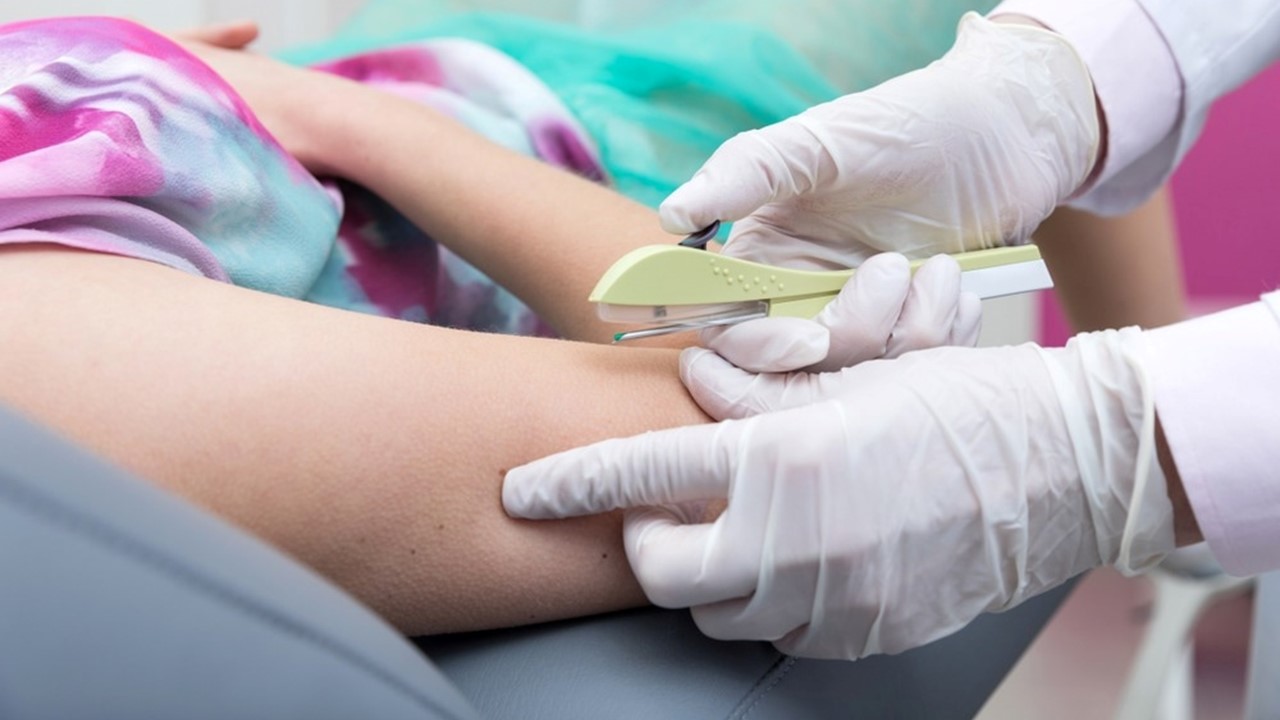 Modernong contraceptives, dapat maging accessible din sa mga kabataan ...